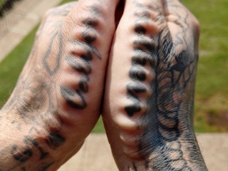 Implant Body Modification